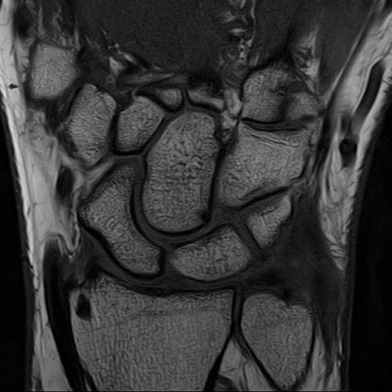 Clinical standard MRI images obtained using Dedicated 3T Extremity ...