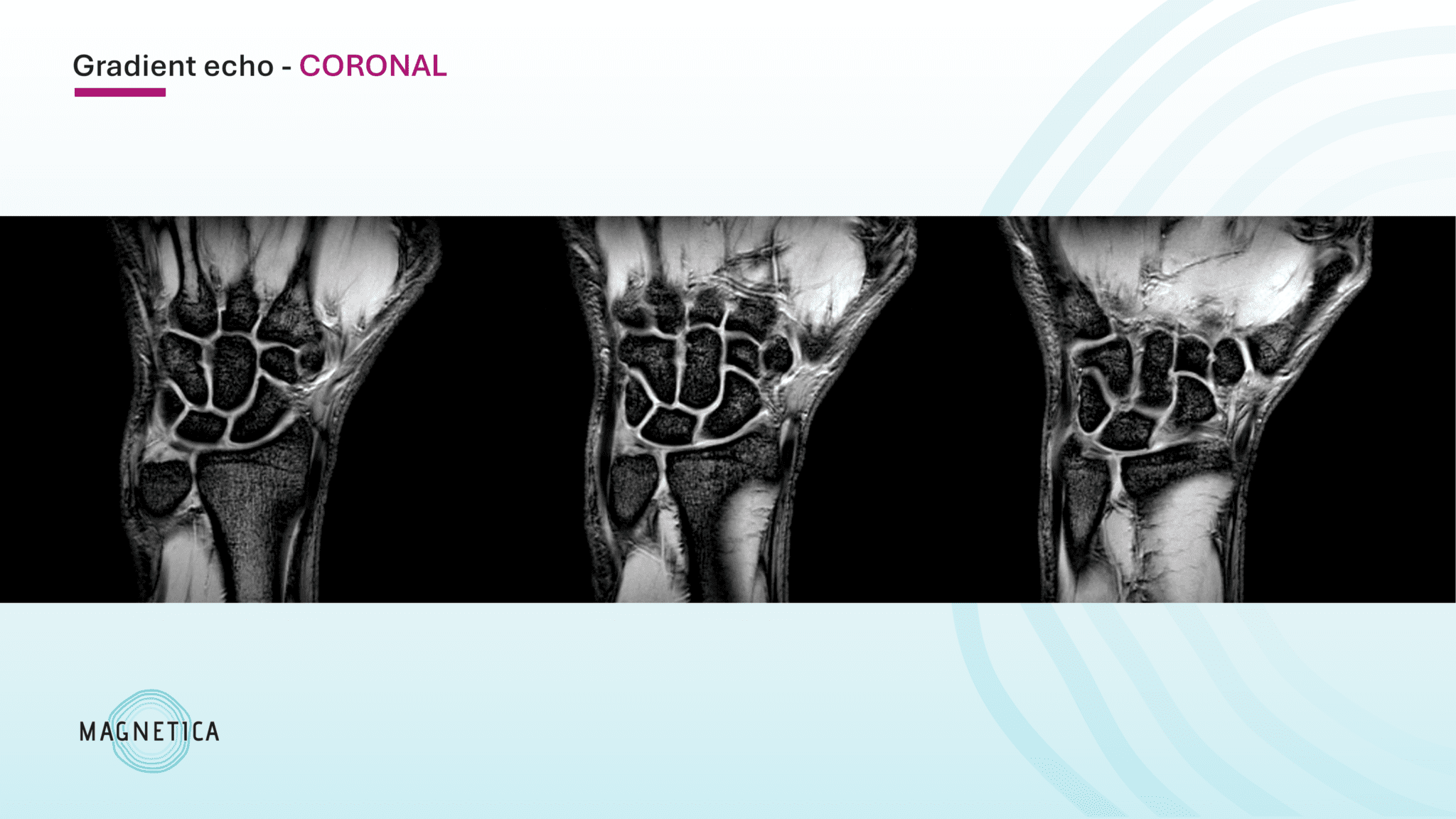 Magnetica high resolution wrist MRI images - September 2024